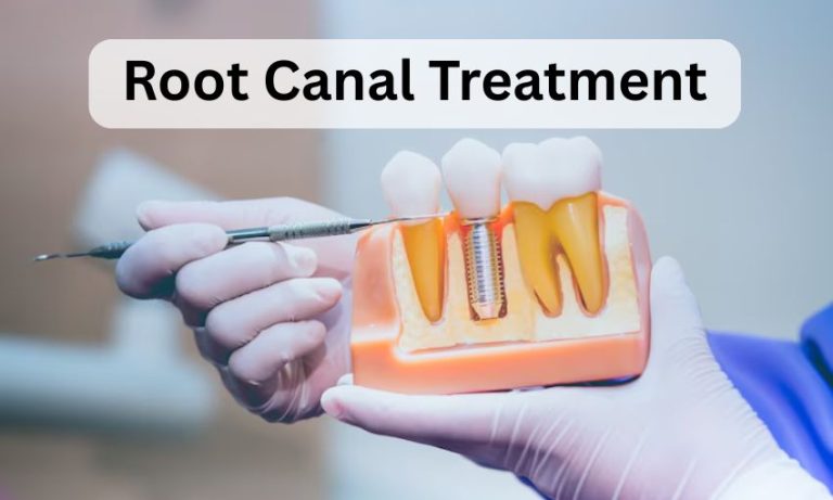 Root Canal Treatment Cost: A Complete Guide - My Hospital Listing
