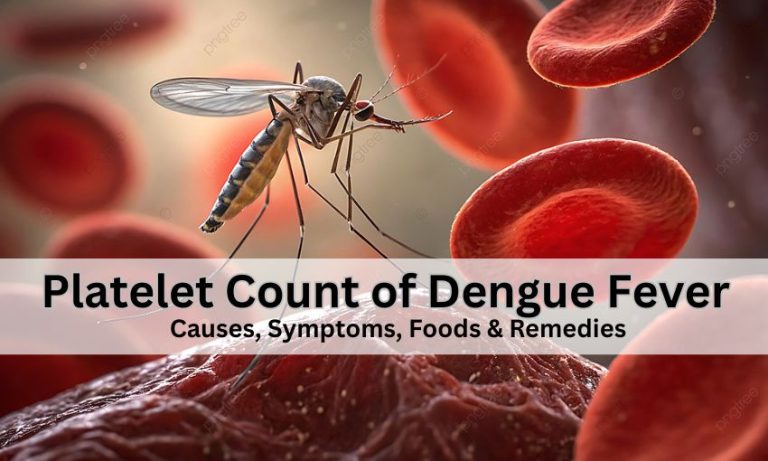 Platelet Count of Dengue Fever: Causes, Symptoms & Remedies