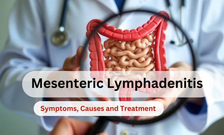 Mesenteric Lymphadenitis: Symptoms, Causes and Treatment
