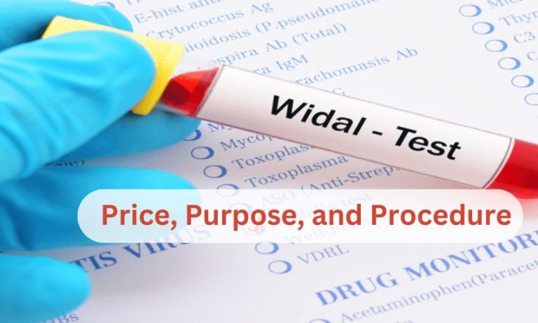 Widal Test Price, Purpose, and Procedure